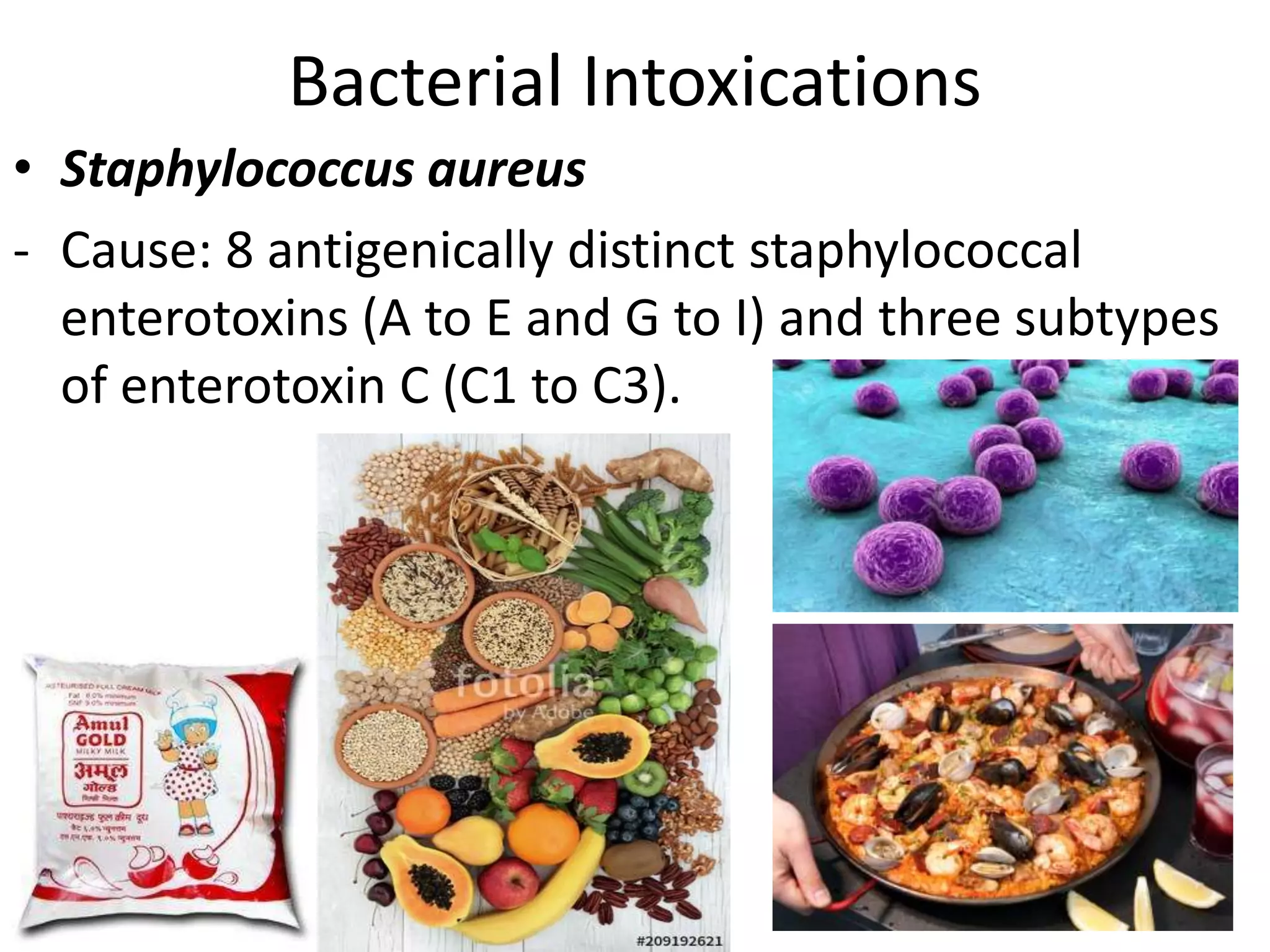 Food poisoning- Microbiology | PPTX