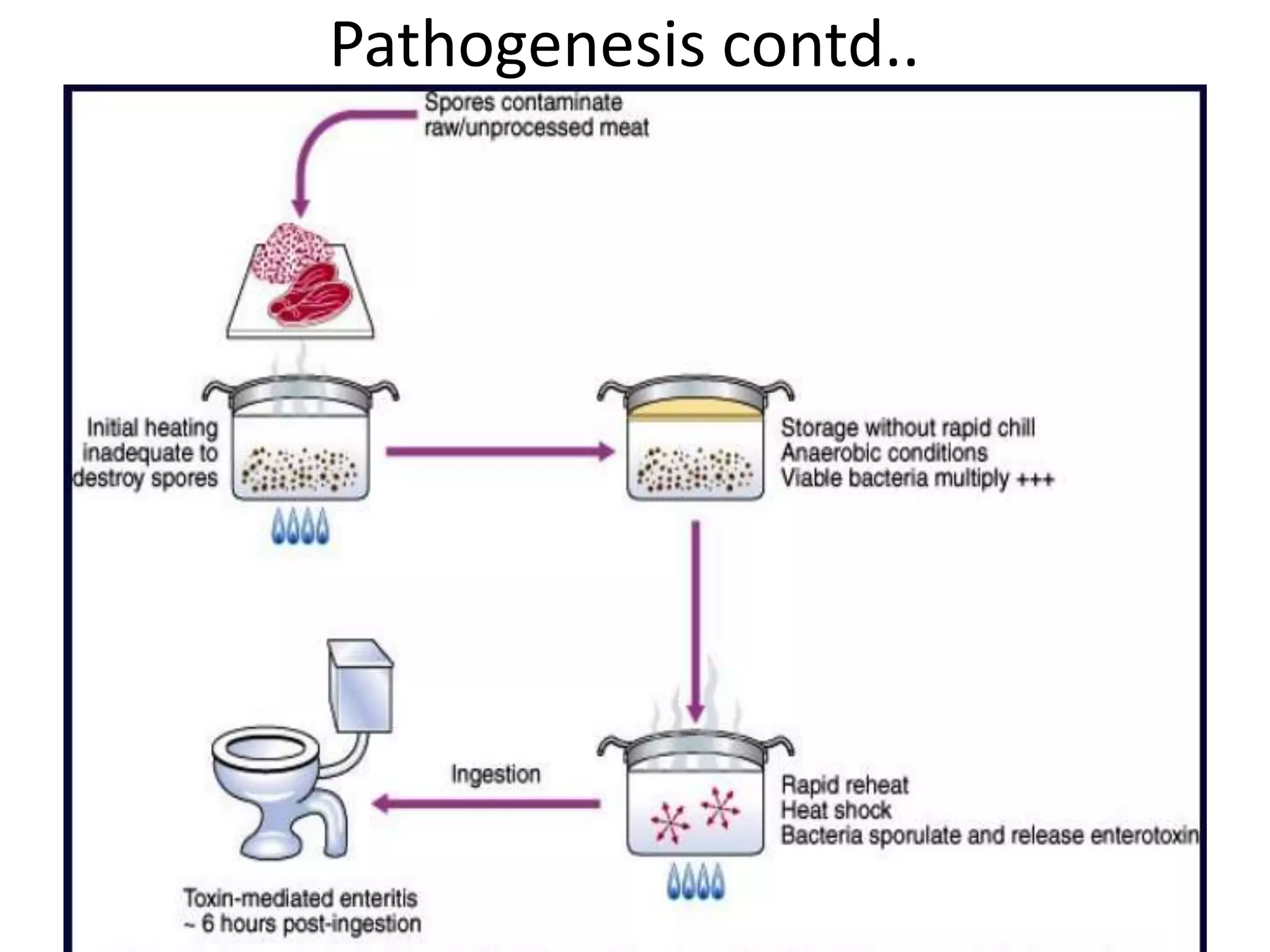 Food poisoning- Microbiology | PPTX