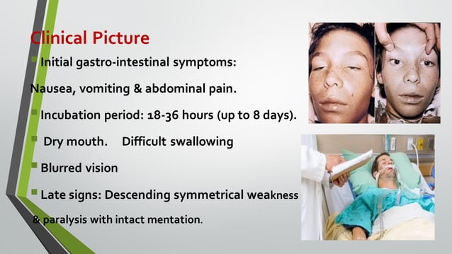 Food poisoning Botulism (1).pdf and pptx | PDF