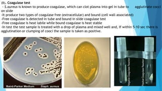 Food safety ( Basic steps in detection of food borne pathogens ) | PPTX