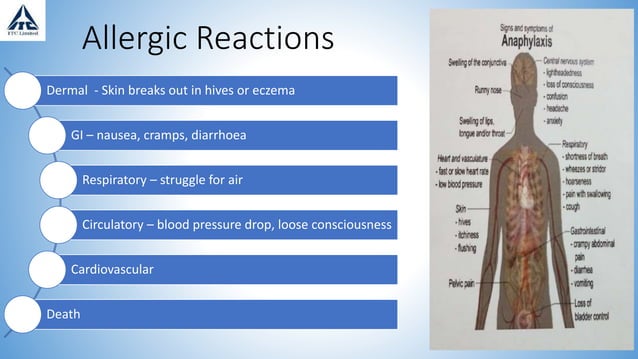 Food safety , OPRP, CCP.pptx | Allergies | Diseases and Conditions