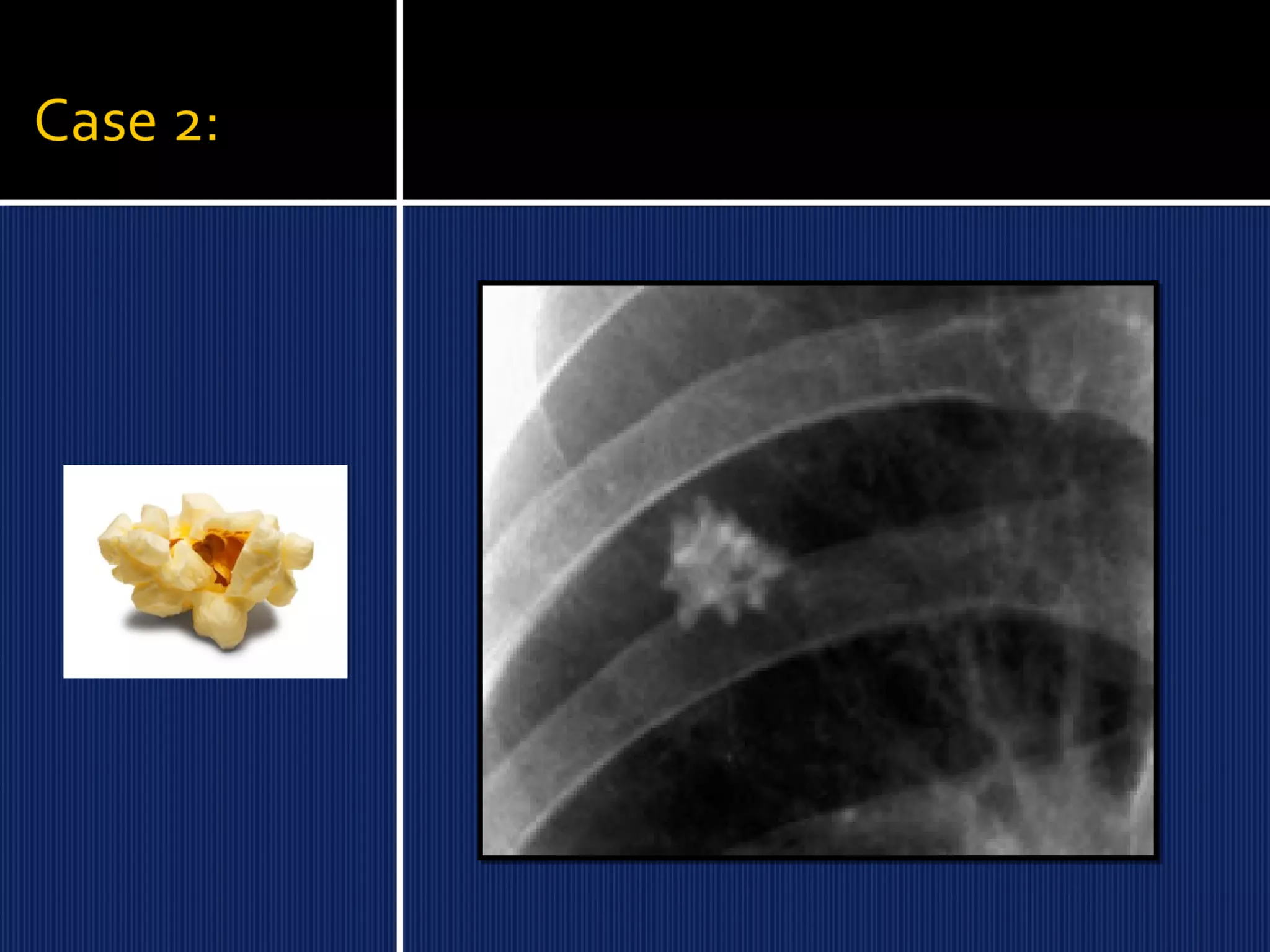 Food Signs in Radiology | PPT
