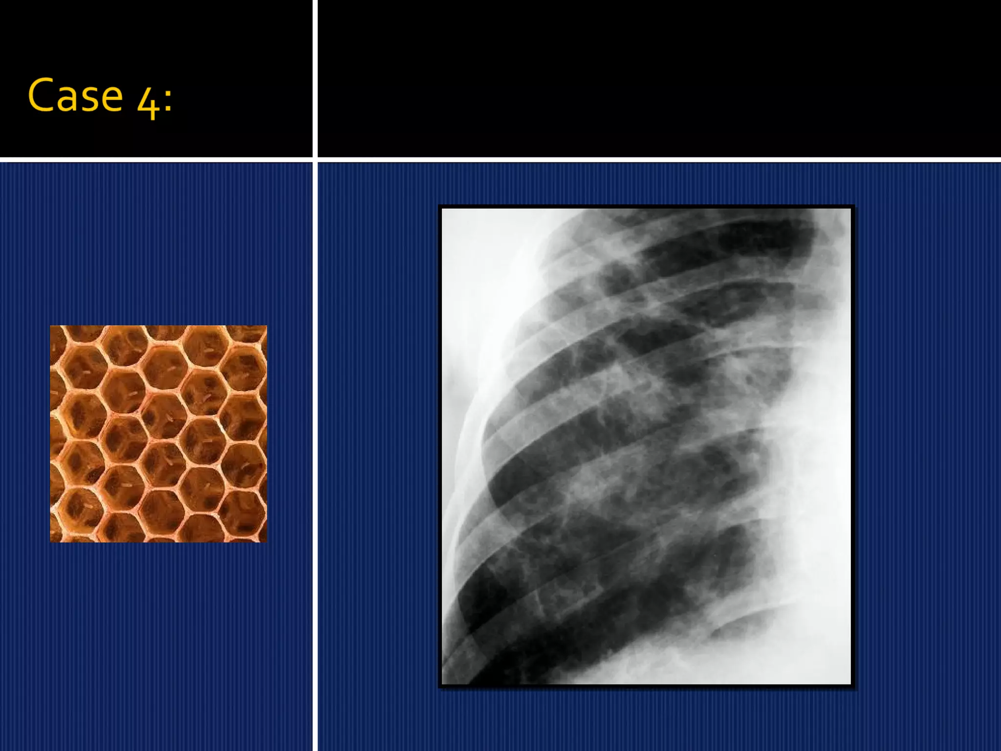 Food Signs in Radiology | PPT