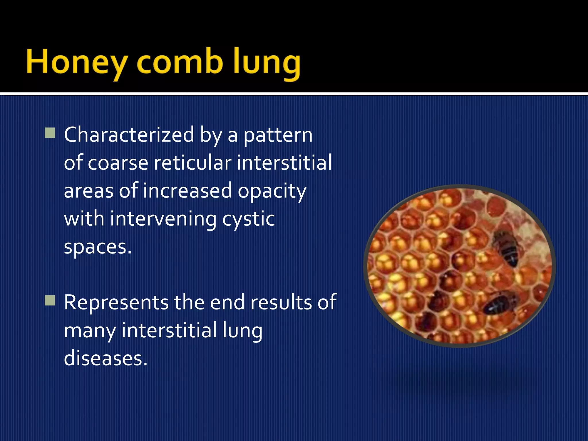Food Signs in Radiology | PPT