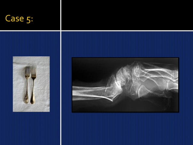Food Signs in Radiology | PPT