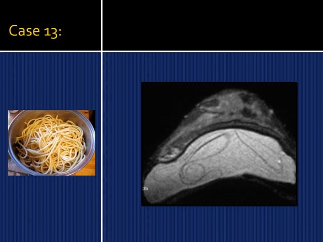 Food Signs in Radiology | PPT