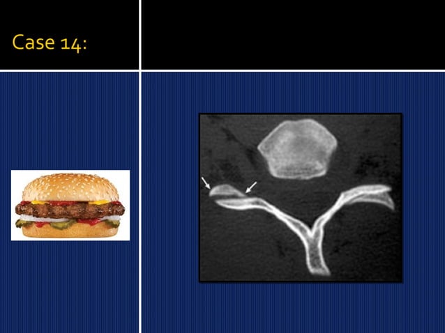 Food Signs in Radiology | PPT