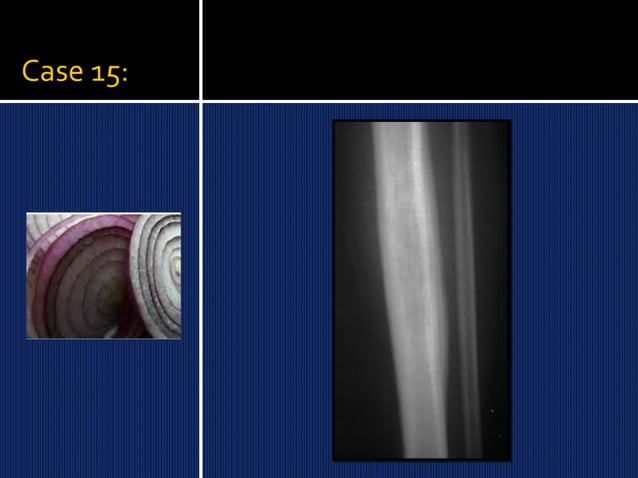 Food Signs in Radiology | PPT