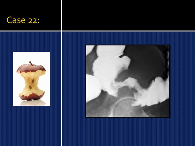 Food Signs in Radiology | PPT