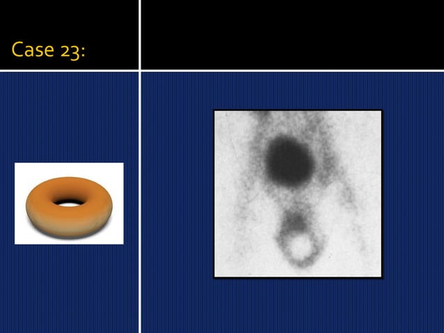 Food Signs in Radiology | PPT