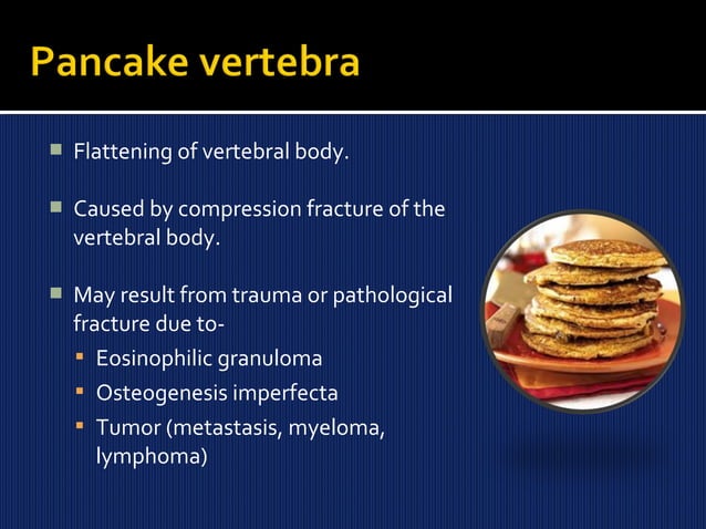 Food Signs in Radiology | PPT