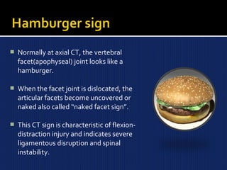 Hamburger Sign Ultrasound