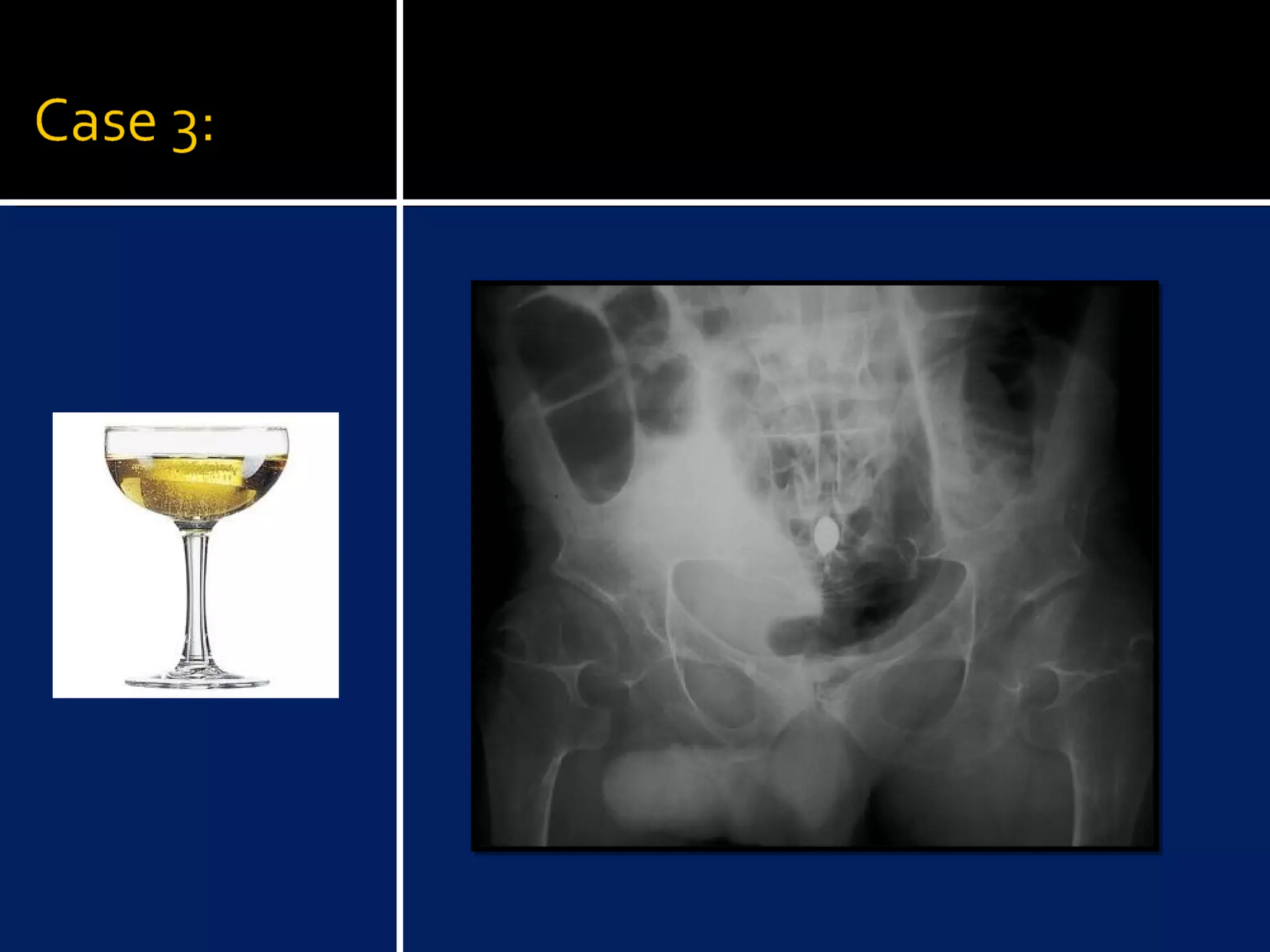 Food signs in radiology | PPT