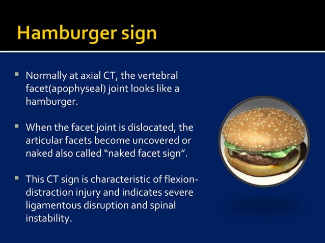 Food signs in radiology | PPT