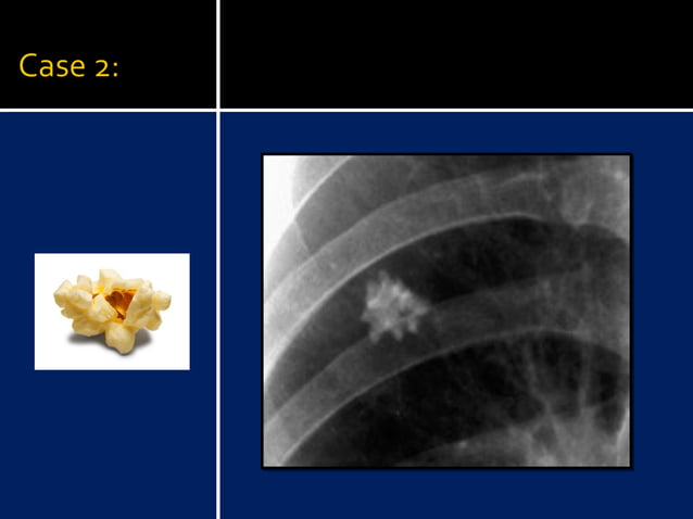 Food signs in radiology | PPT