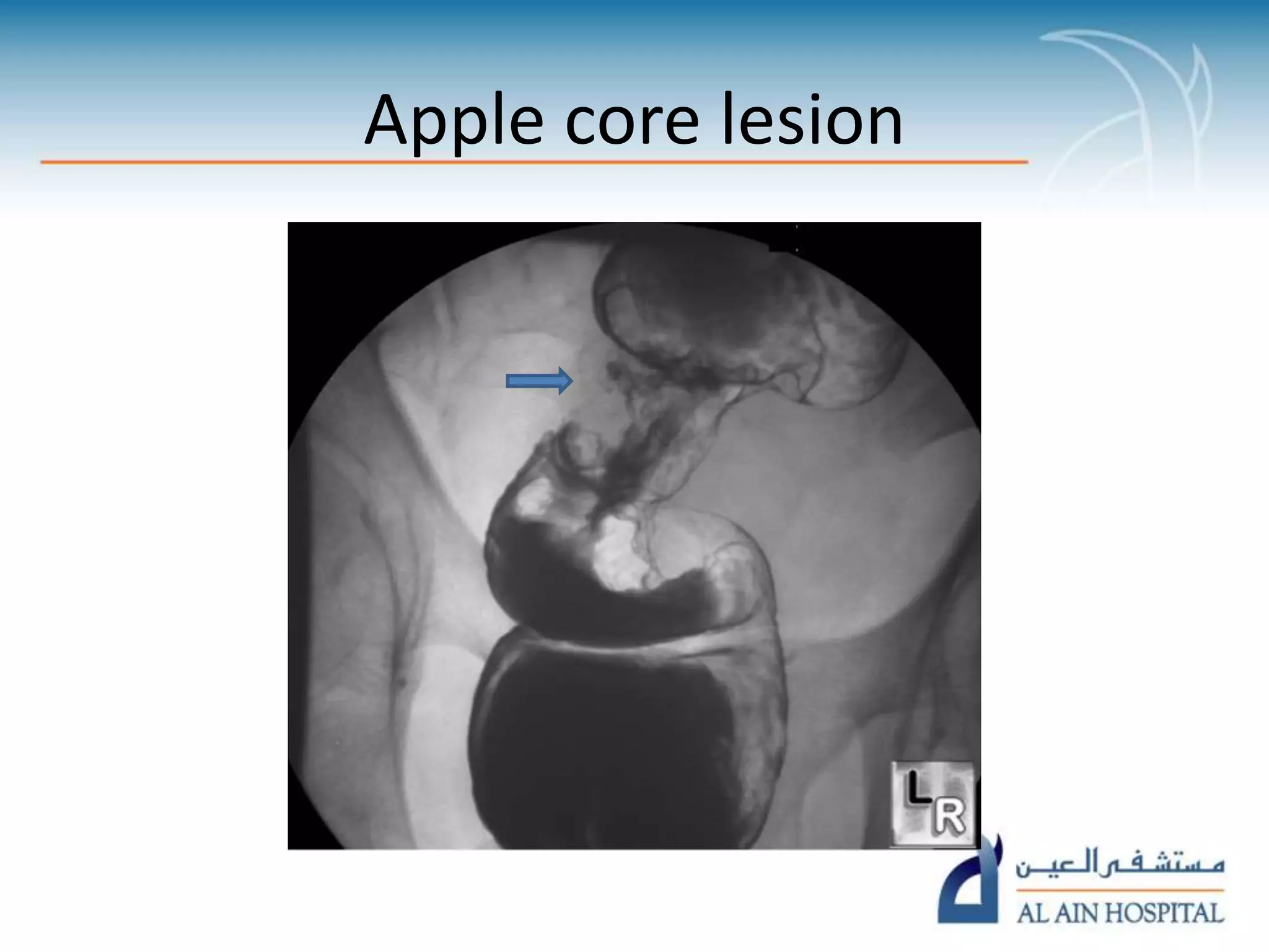 Food signs in radiology pp ta | PPTX