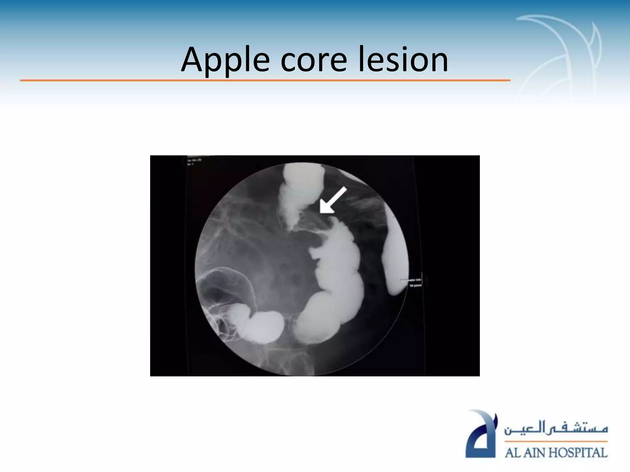 Food signs in radiology pp ta | PPTX