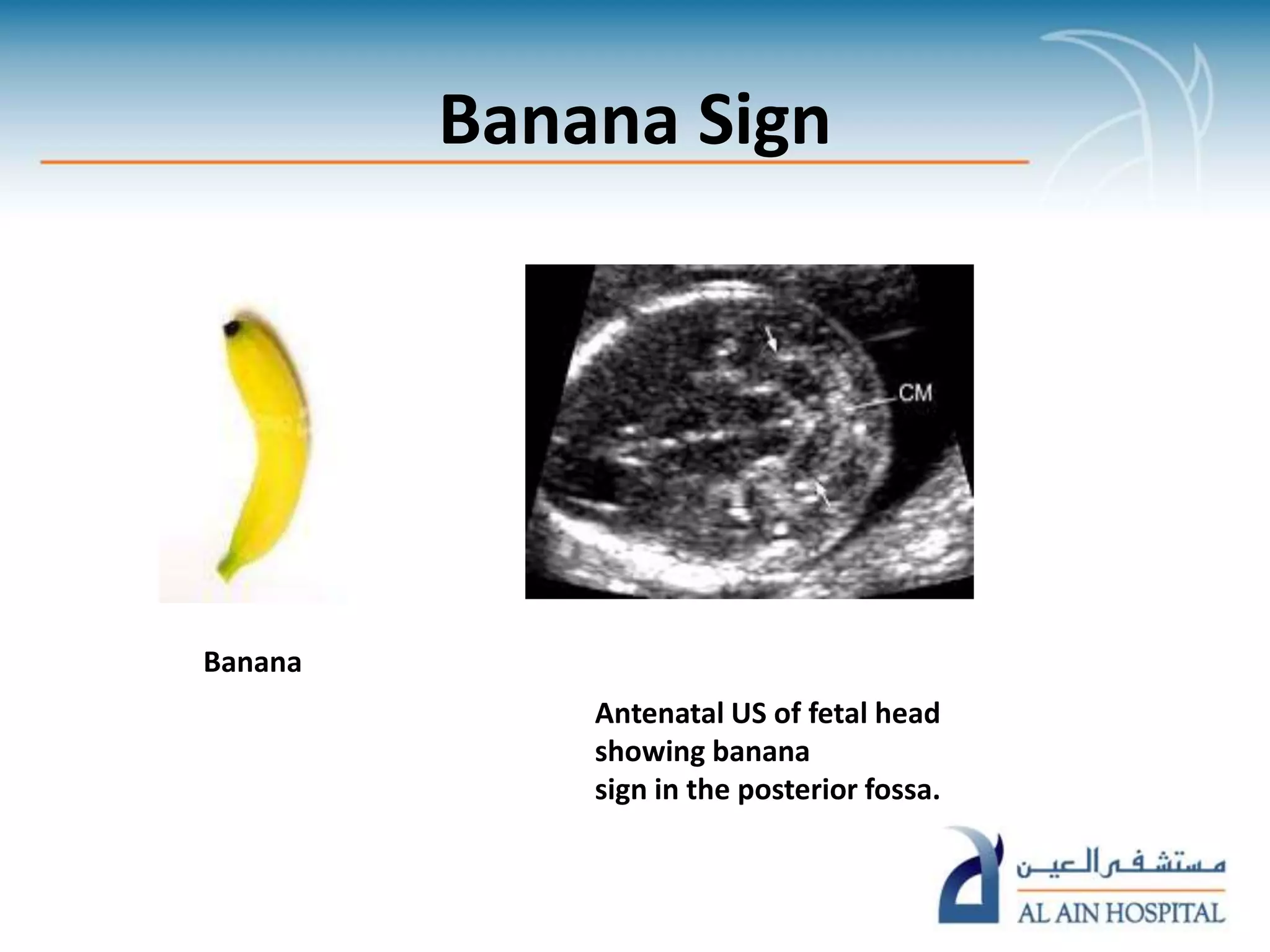 Food signs in radiology pp ta | PPTX