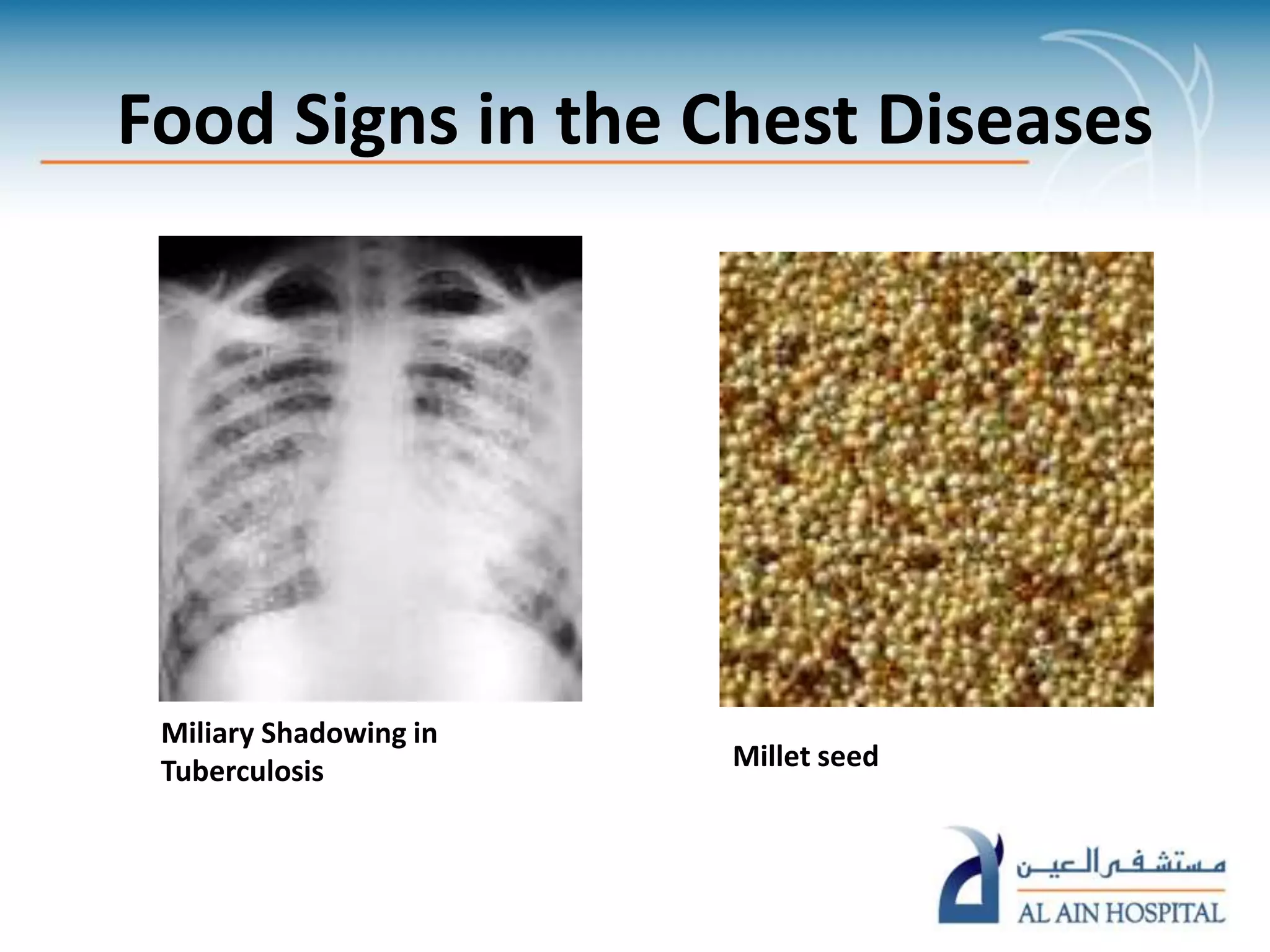 Food signs in radiology pp ta | PPTX