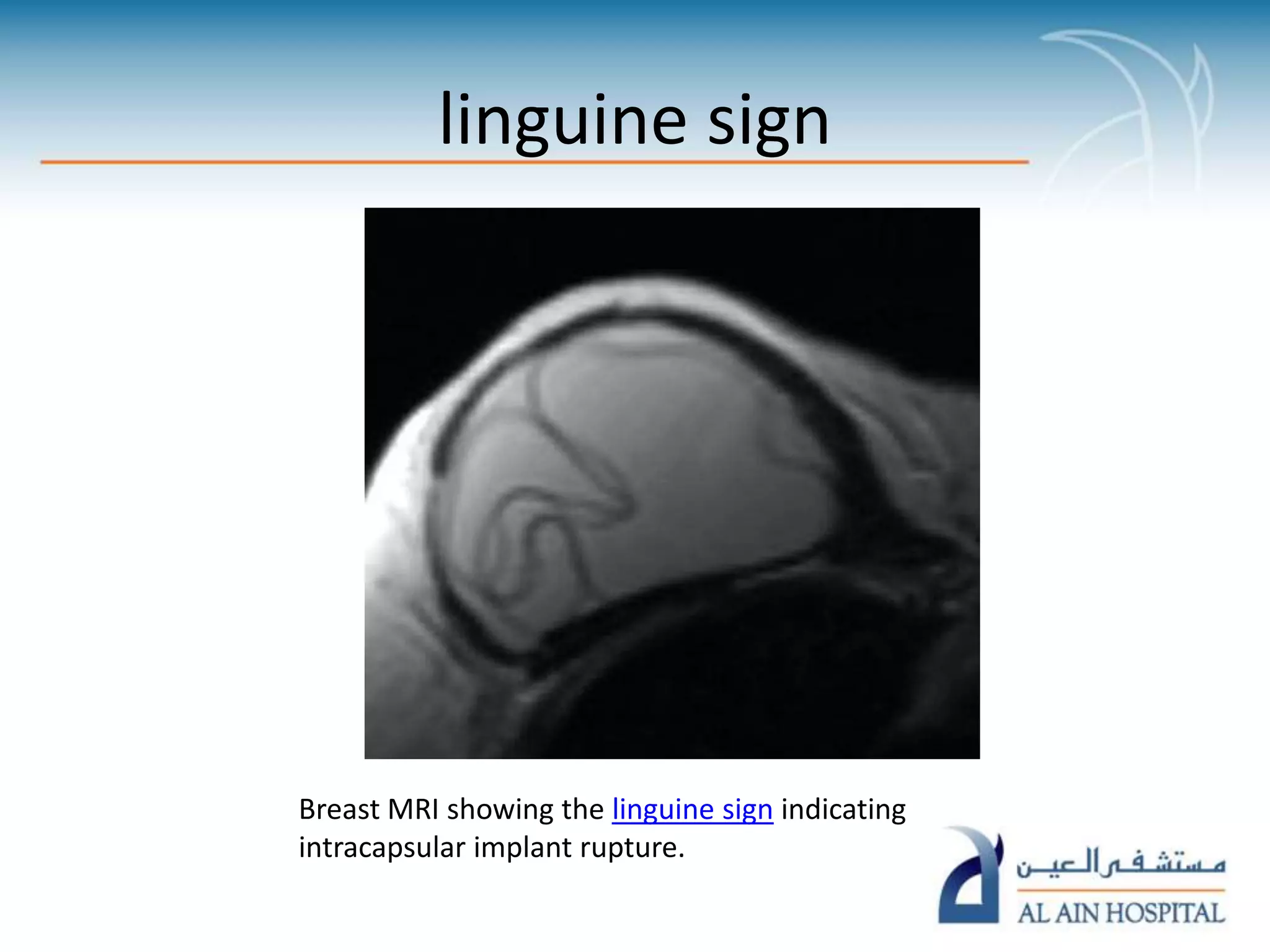 Food signs in radiology pp ta | PPTX
