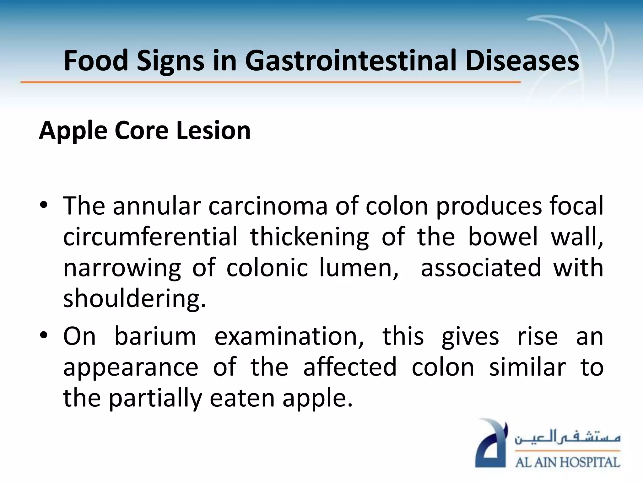Food signs in radiology pp ta | PPTX