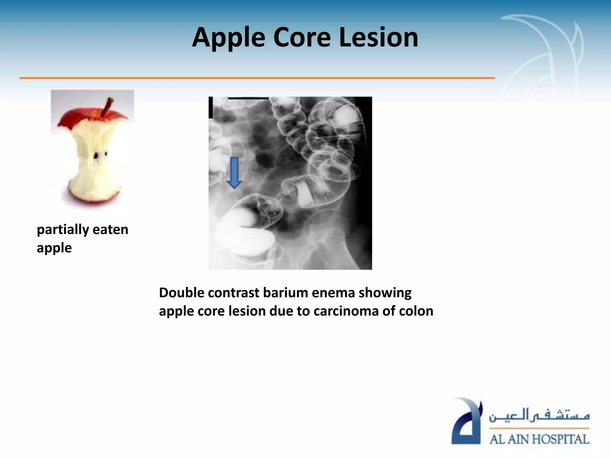 Food signs in radiology pp ta | PPTX