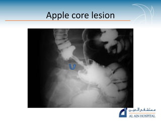 Food signs in radiology pp ta | PPTX
