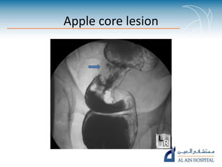 Food signs in radiology pp ta | PPTX