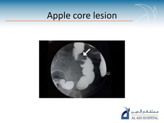 Food signs in radiology pp ta | PPTX