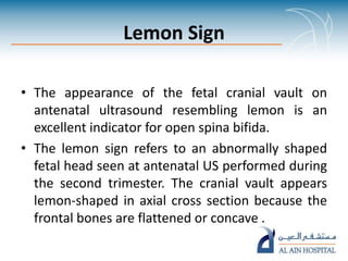 Food signs in radiology pp ta | PPTX