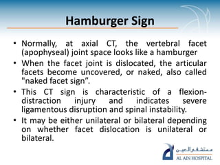 Food signs in radiology pp ta | PPTX