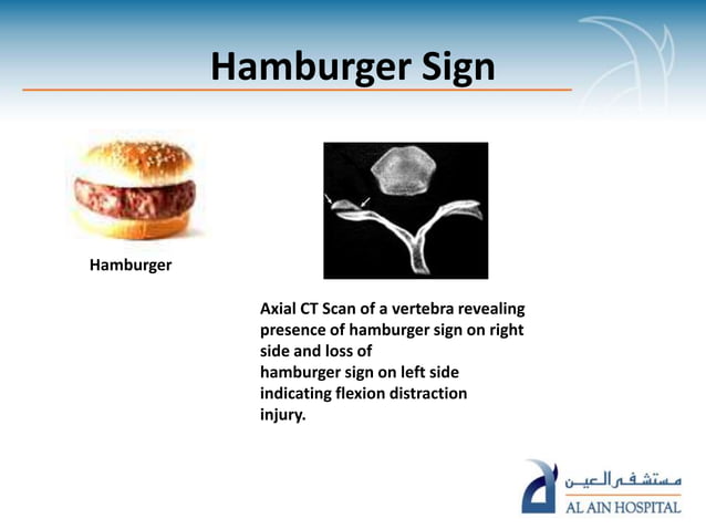 Food signs in radiology pp ta | PPT