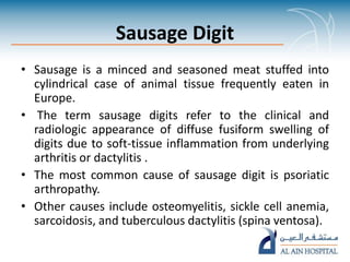 Food signs in radiology pp ta | PPTX