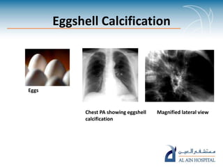 Food signs in radiology pp ta | PPTX