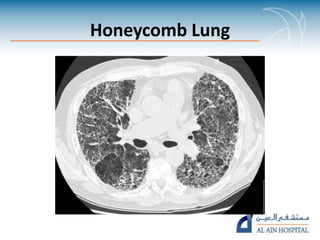 Food signs in radiology pp ta | PPTX