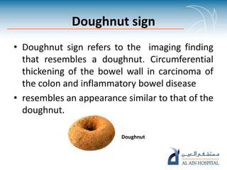Food signs in radiology pp ta | PPTX