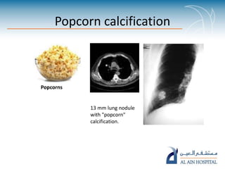 Food signs in radiology pp ta | PPTX