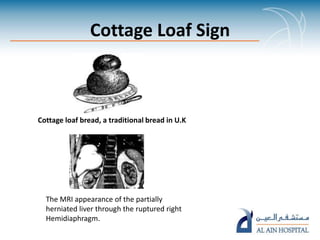 Food signs in radiology pp ta | PPTX