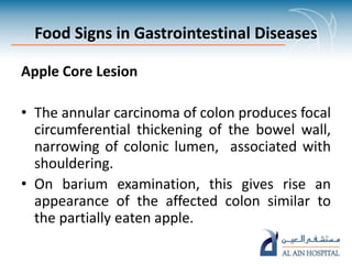 Food signs in radiology pp ta | PPTX