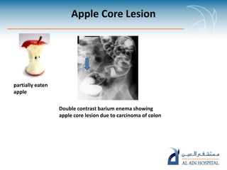 Food signs in radiology pp ta | PPTX