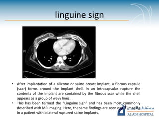 Food signs in radiology pp ta | PPT