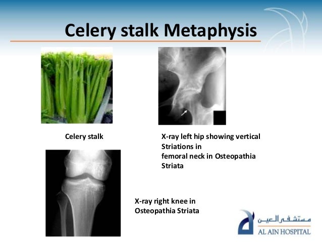 Food signs in radiology pp ta
