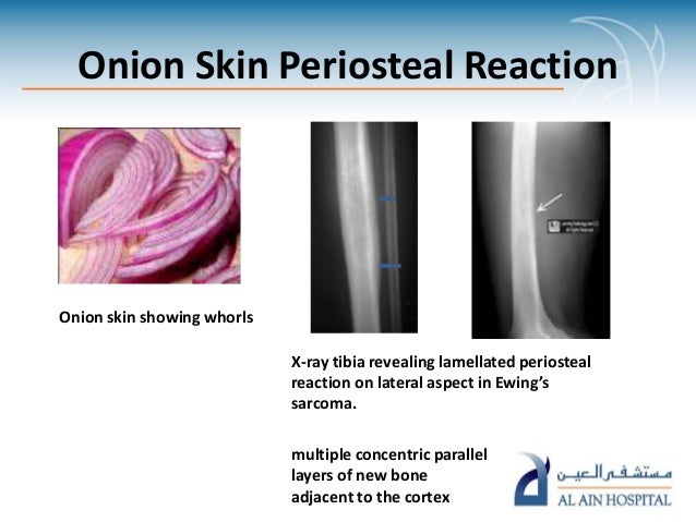 Food signs in radiology pp ta
