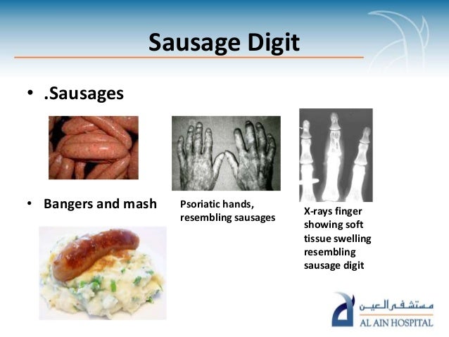 Food signs in radiology pp ta