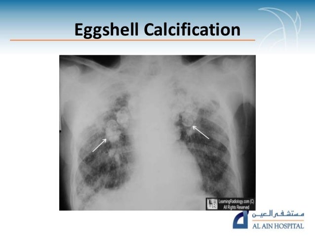 Food signs in radiology pp ta