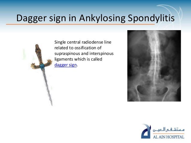 Food signs in radiology pp ta