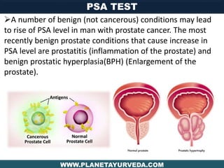 Foods That Reduce PSA Level | PPTX