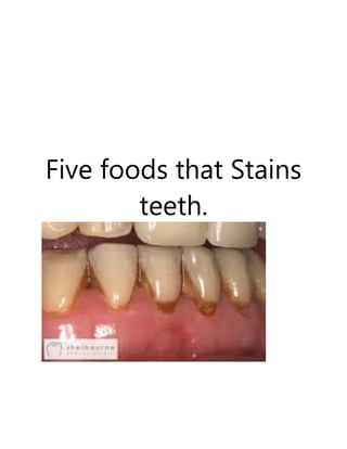 Foods that stains teeth. | PDF