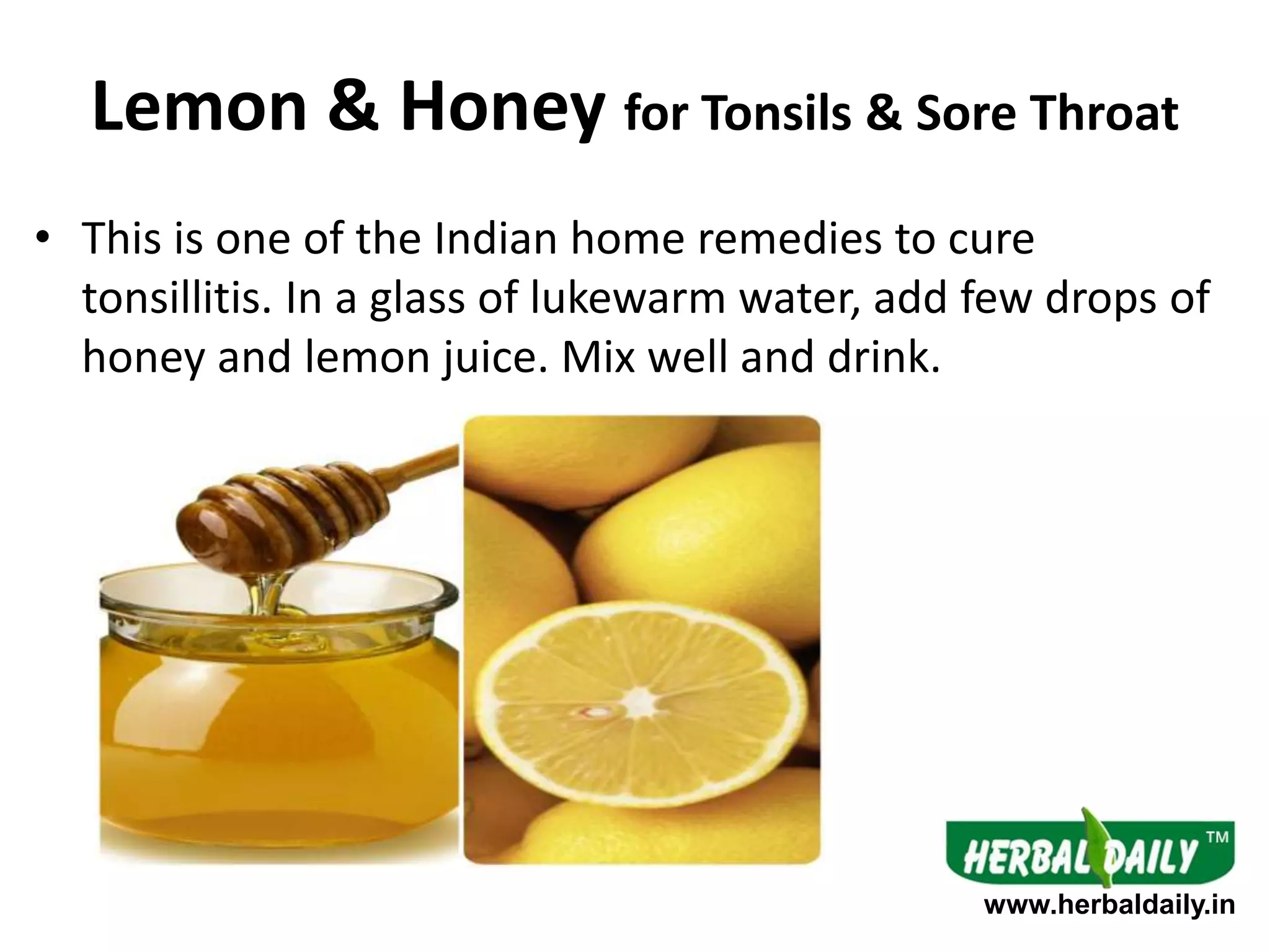 Foods to Eat & Avoid in Tonsils & Sore Throat | PPTX