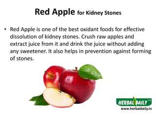 Foods to Eat in Kidney Stones | PPT
